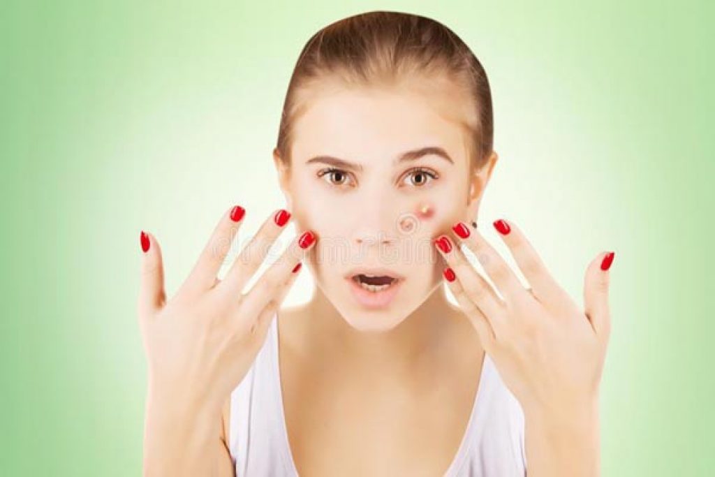 Anatomy Of Acne: Why Do You Get Acne And How Can You Treat It? 2026